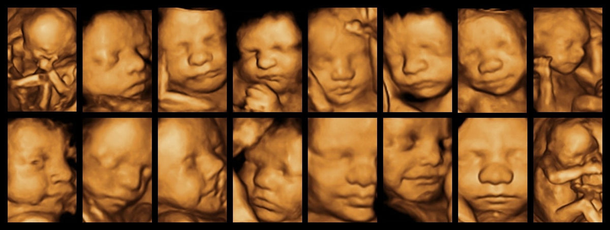 Watch Me Grow Bundle – Oh Baby Cairns